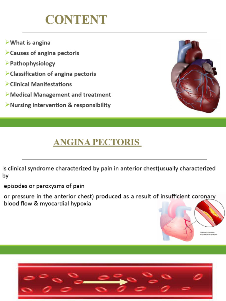 Angina Pectoris,Seminar | PDF | Coronary Artery Disease | Medicine