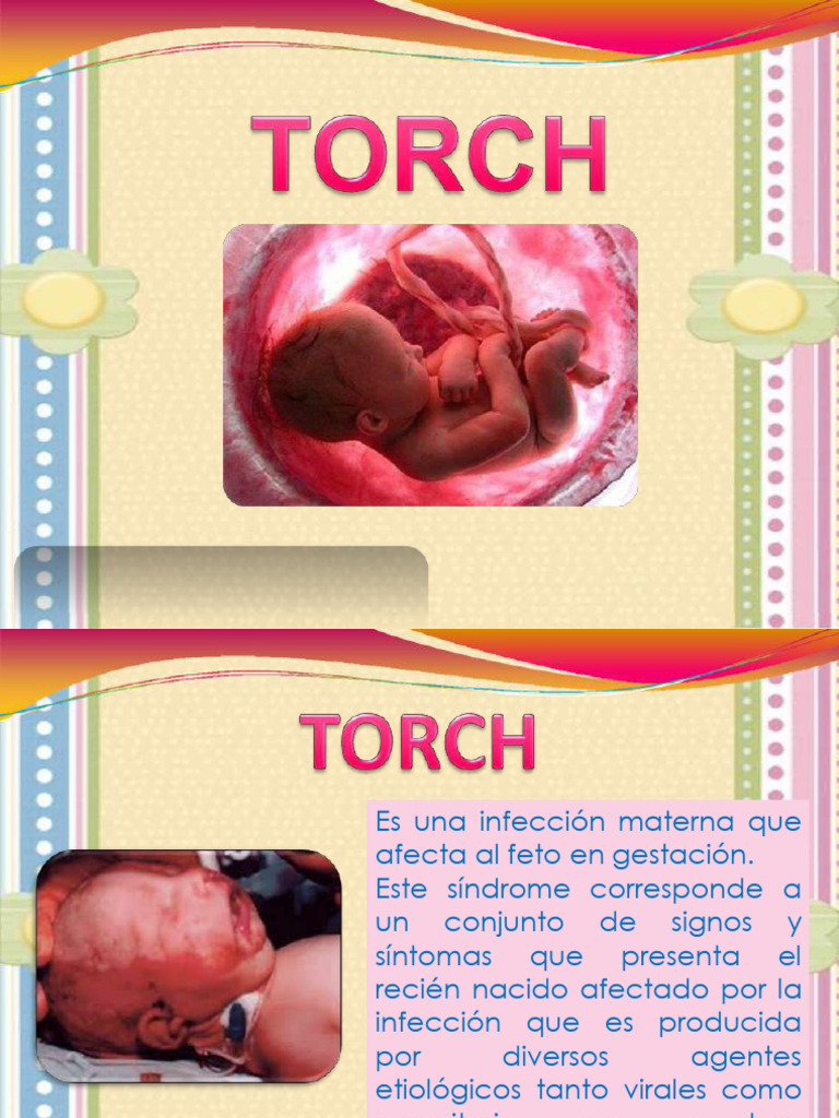 Sindrome de Torch | PDF | Virus | Infección