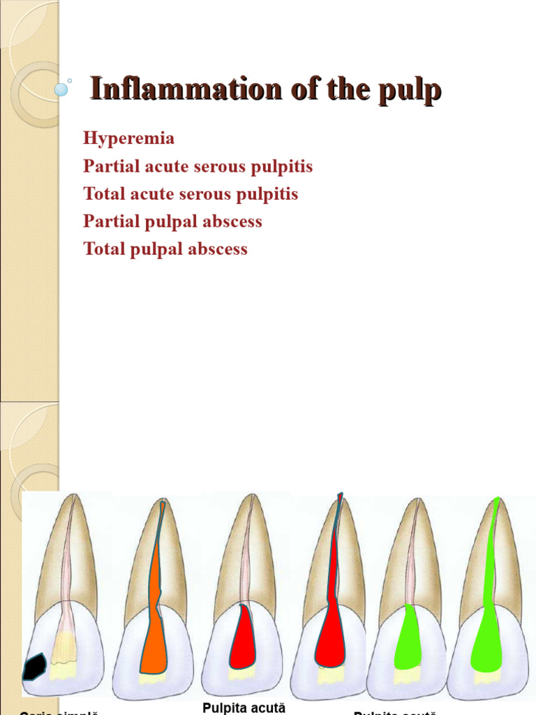 Curs 10-Pulp Pathology II-1 | PDF | Medical Specialties | Clinical Medicine