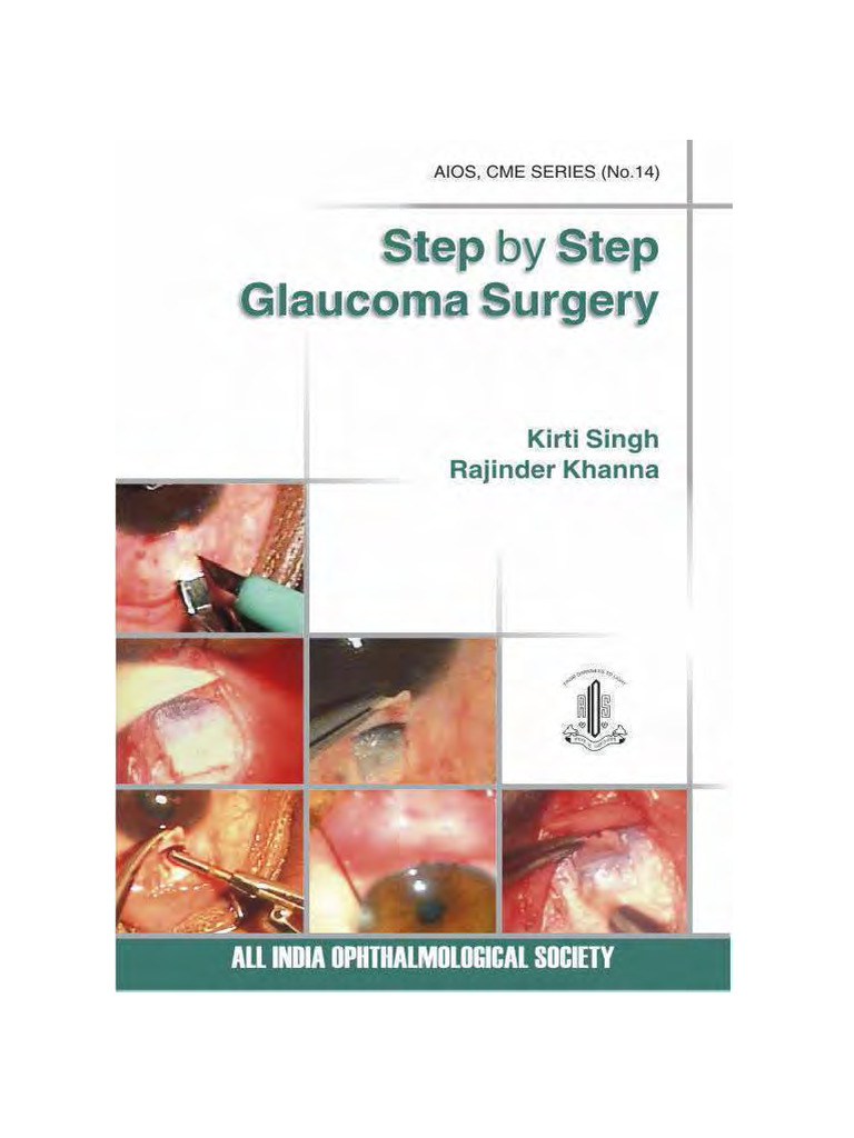 Aios Glaucoma SX | PDF | Glaucoma | Visual Impairment