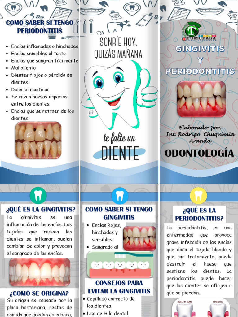 Prevención y síntomas de gingivitis | PDF