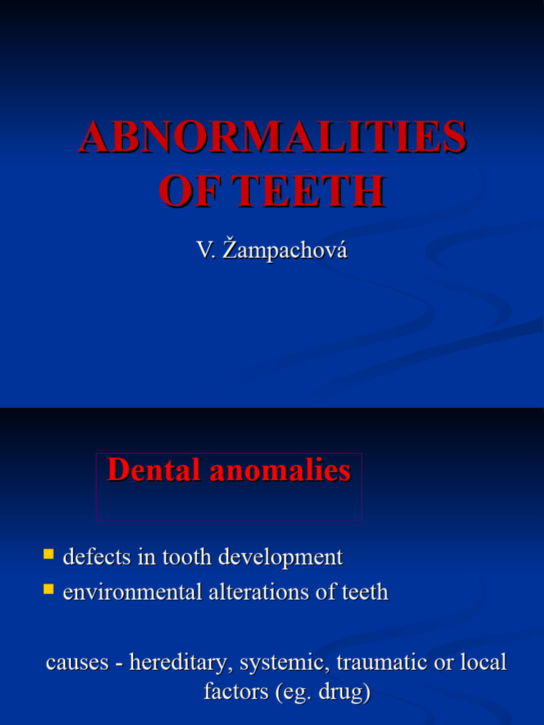 Abnormalities of Teeth | PDF | Human Tooth | Tooth Enamel