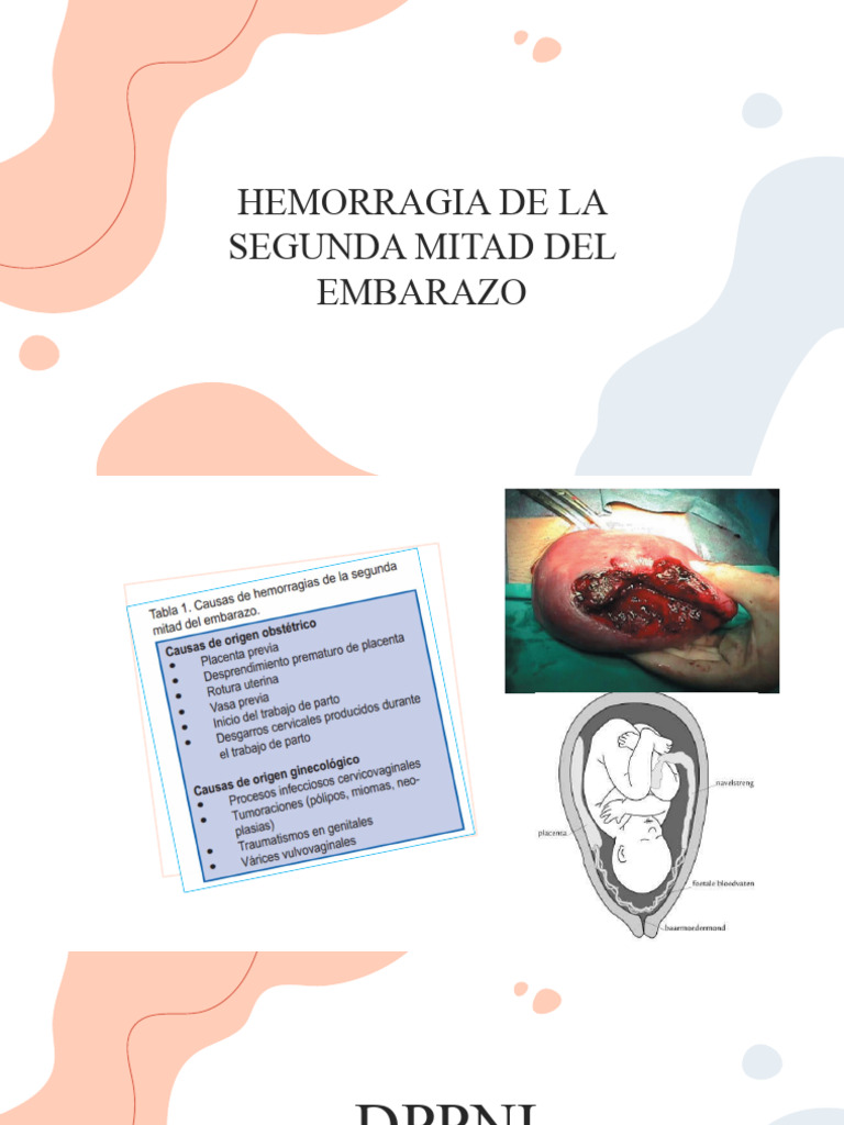 Dppni | PDF | El embarazo | Feto