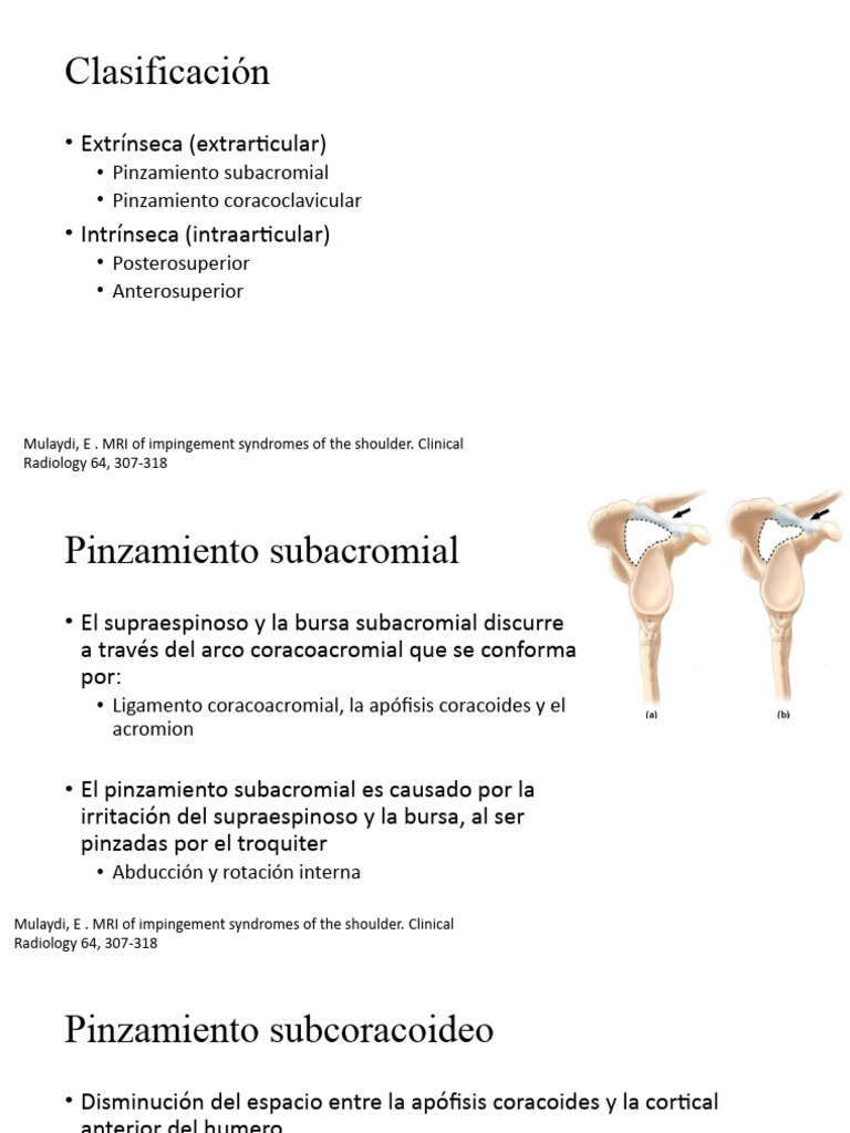Pinzamiento Subacromial | PDF | Hombro | Sistema musculoesquelético