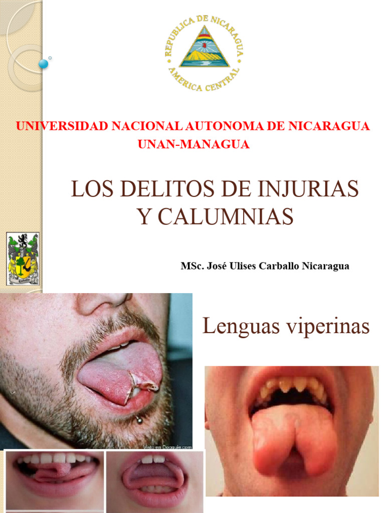 Delitos de Injuria y Calumnia | PDF | Ley común | Justicia