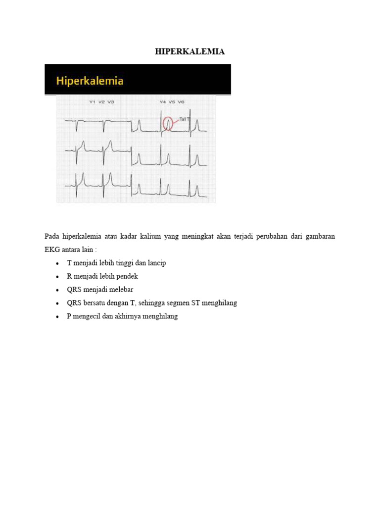 HIPERKALEMIA | PDF