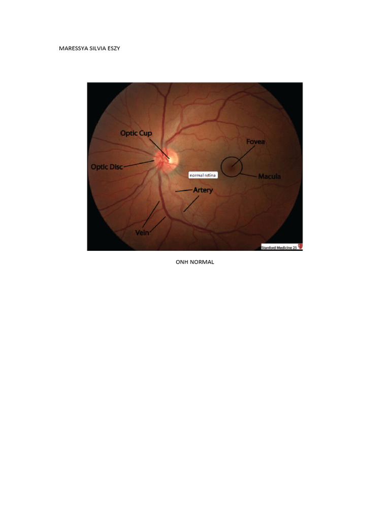 Fundus Atlas | PDF