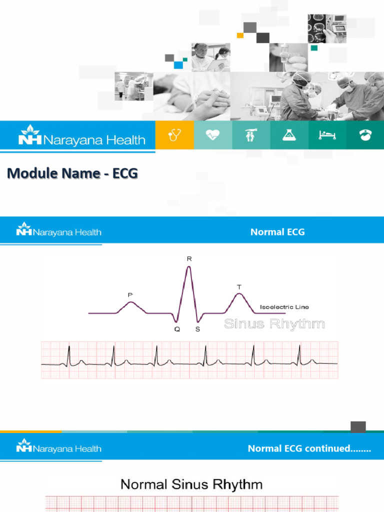Module Name - ECG | PDF