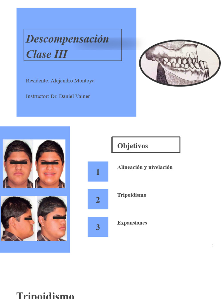 Compensación Clase III | PDF