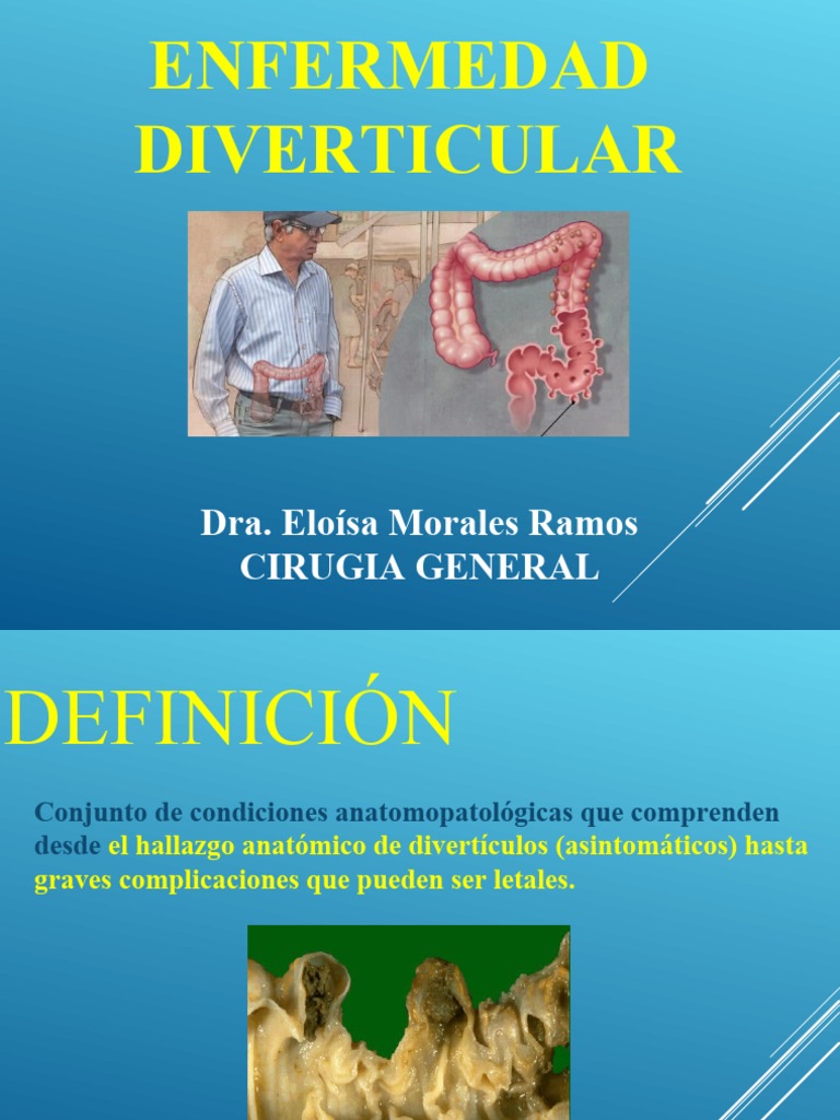 Enfermedad Diverticular: Definición y Complicaciones | PDF ...