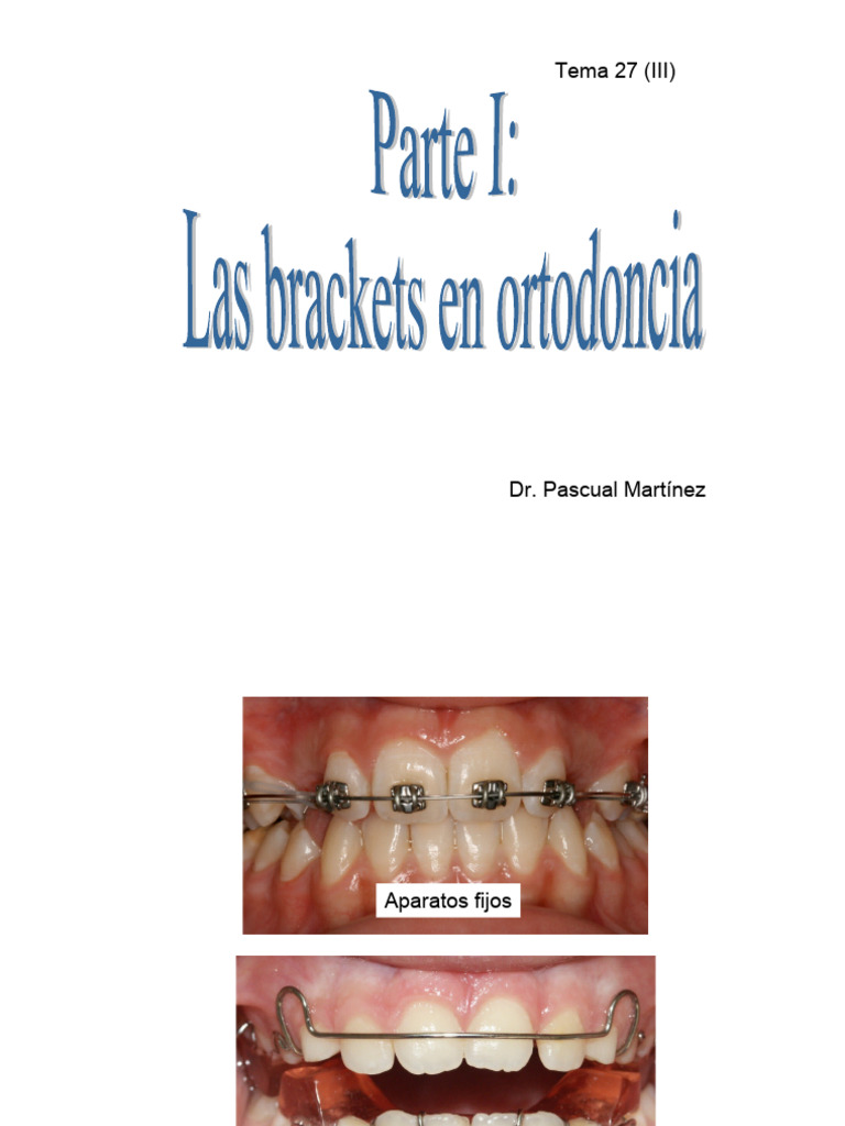t.27 (III) - Los Brackets y Alambres en Ortodoncia | PDF | Ortodoncia ...