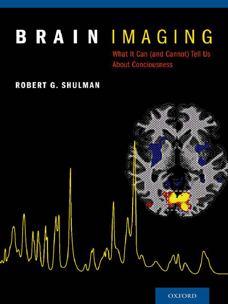 Dokumen - Pub - Brain Imaging What It Can and Cannot Tell Us About Consciousness 1nbsped ...