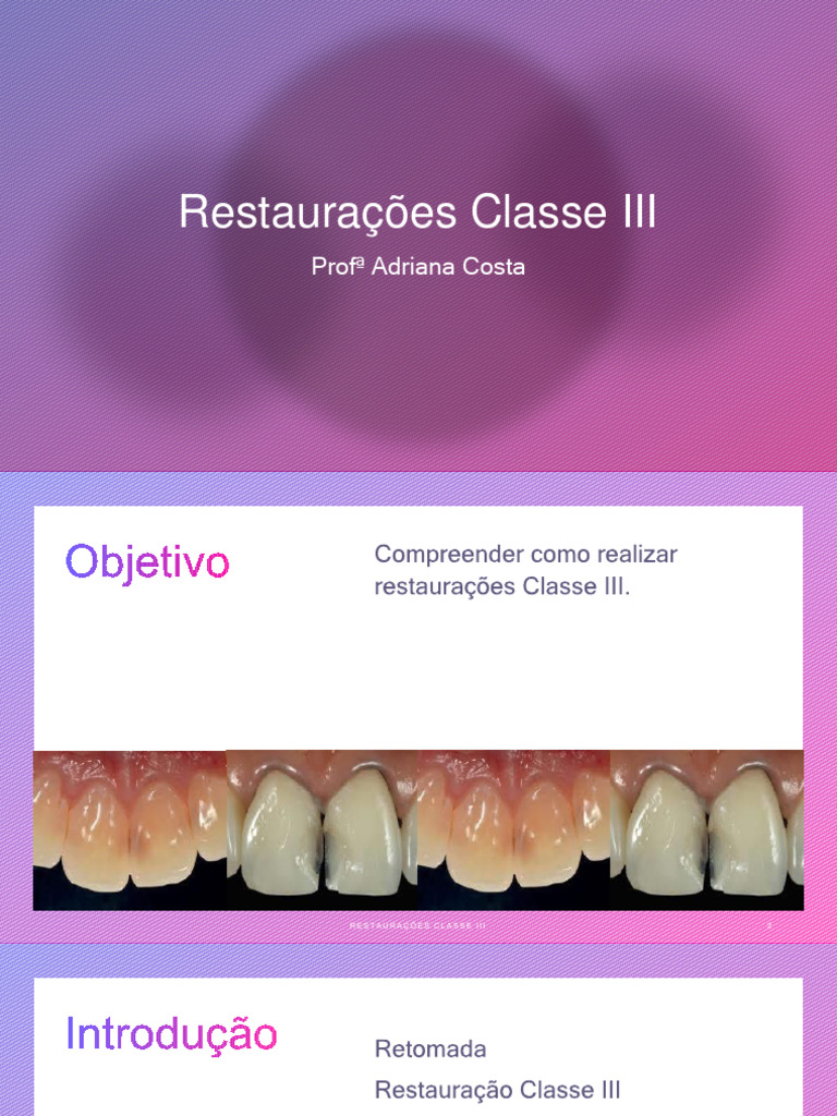 Restaurações Classe III | PDF