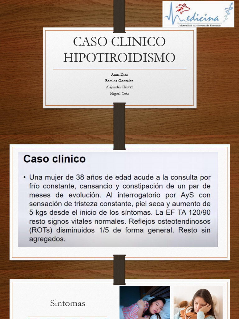 Hipotiroidismo Expo | PDF | Hipotiroidismo | Tiroides