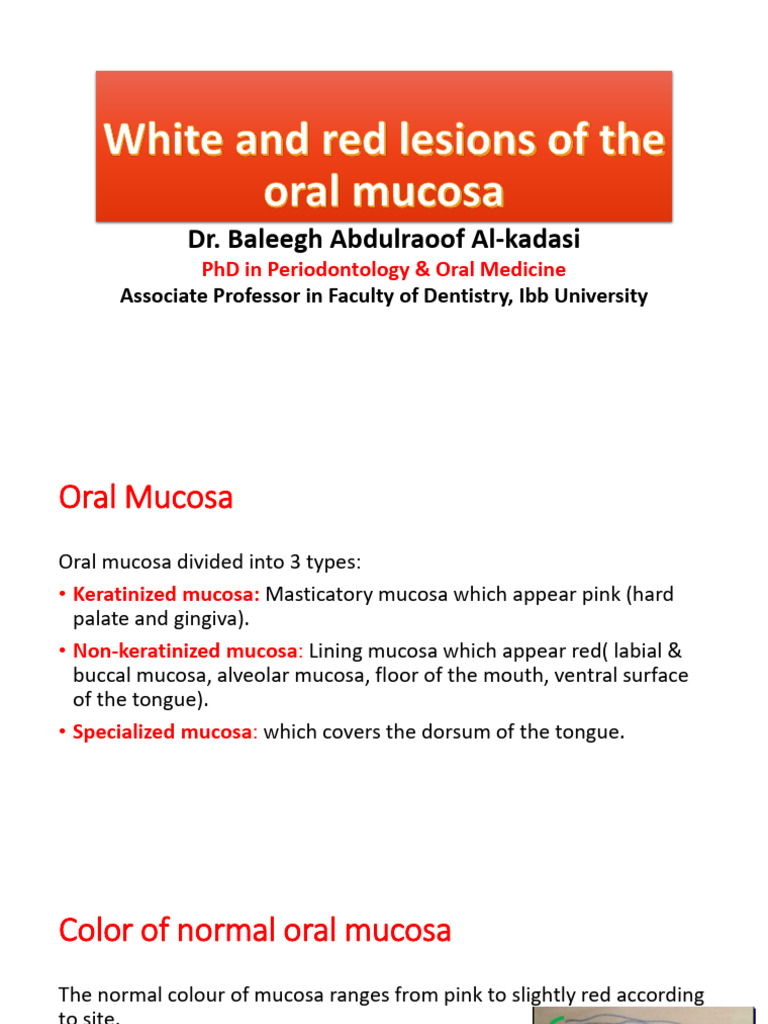 Oral Mucosa: Red and White Lesions Overview | PDF | Candidiasis ...