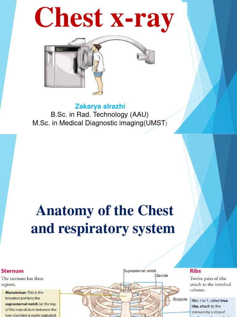 Chest X-Ray | PDF