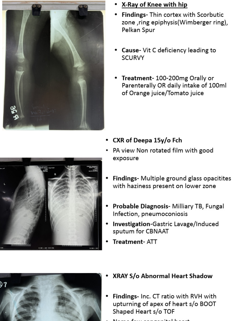 X Rays Pediatric Viva | PDF | Lung | Heart