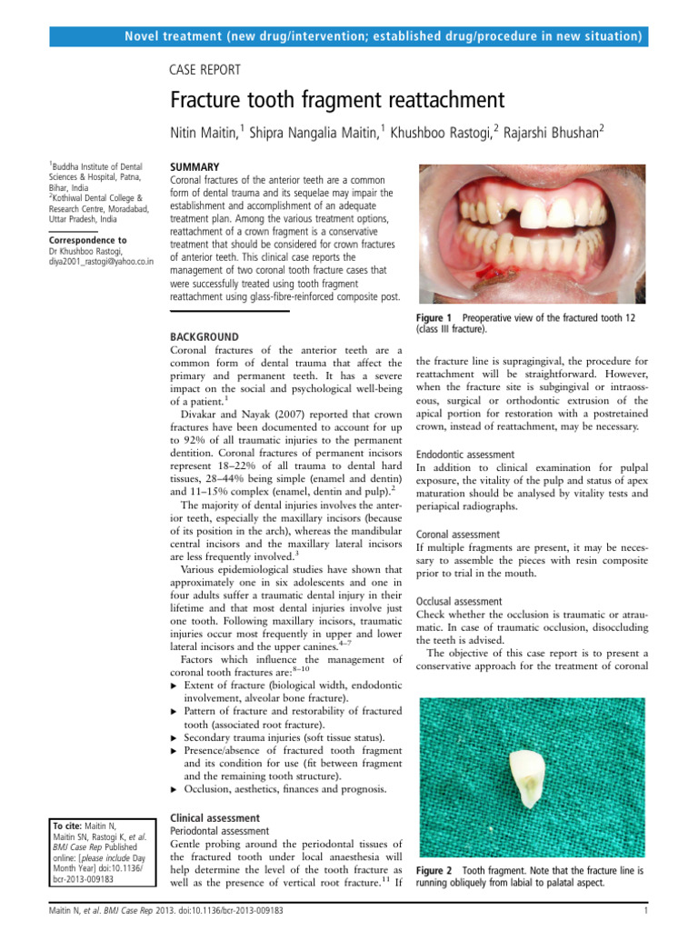 Fracture Ellis - Journal Radiography Acc | PDF