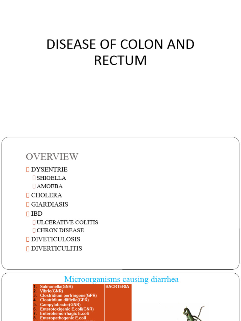 Disease of Colon and Rectum | PDF | Esophagus | Cholera