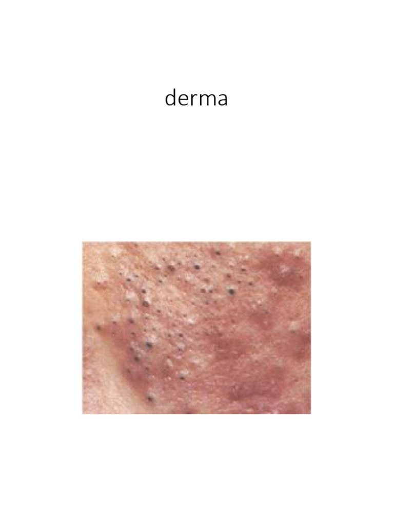 Derma Imagenes - Merged | PDF | Psoriasis | Condiciones cutáneas
