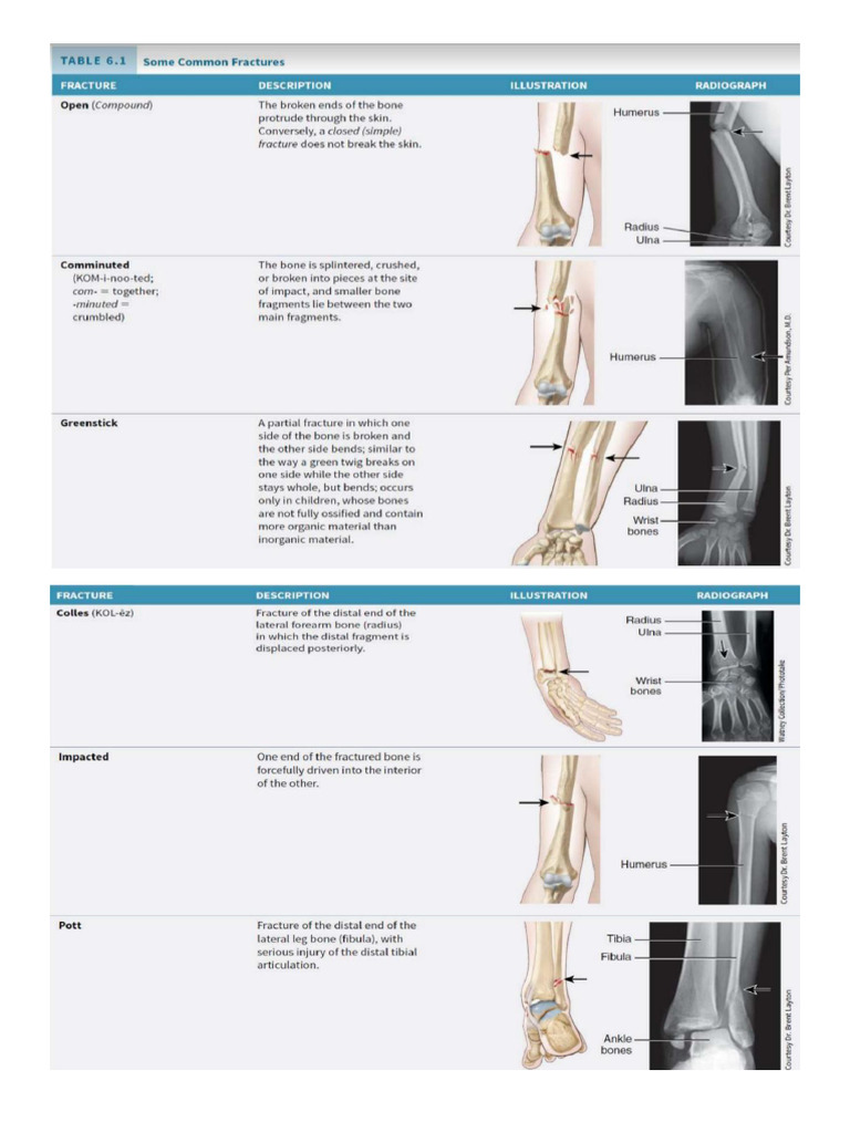 The Skeletal System Tables | PDF