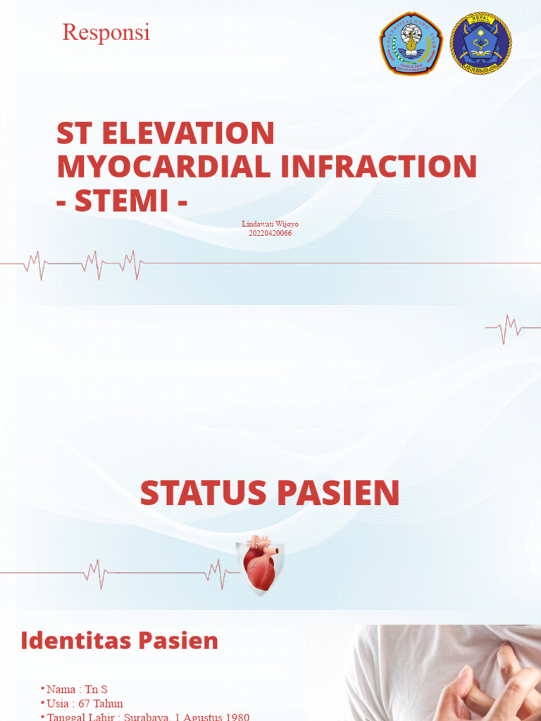 Stemi | PDF