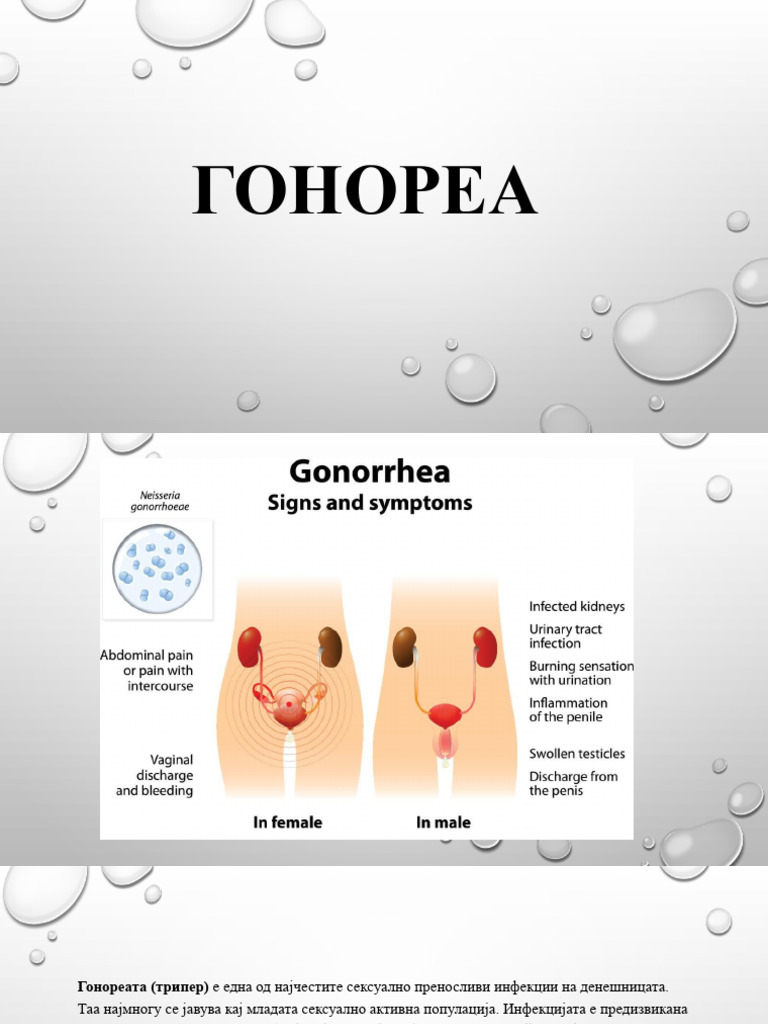 Gonorrhea | PDF