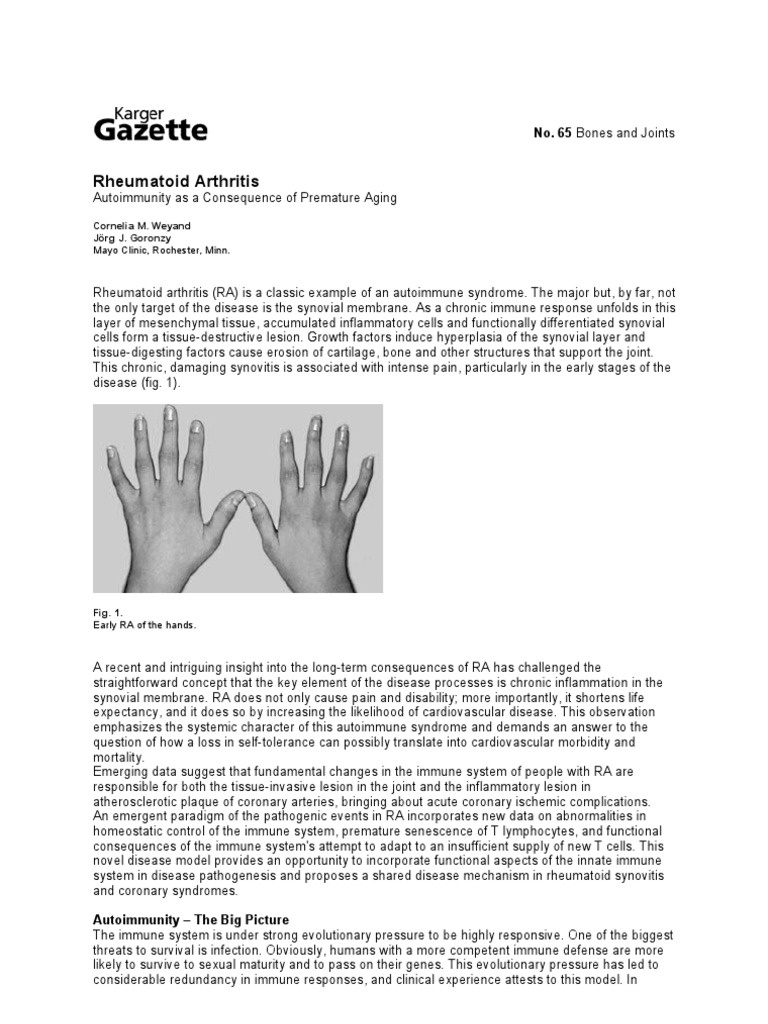 Ra and Cardiovascular Morbidity | PDF | T Cell | Natural Killer Cell