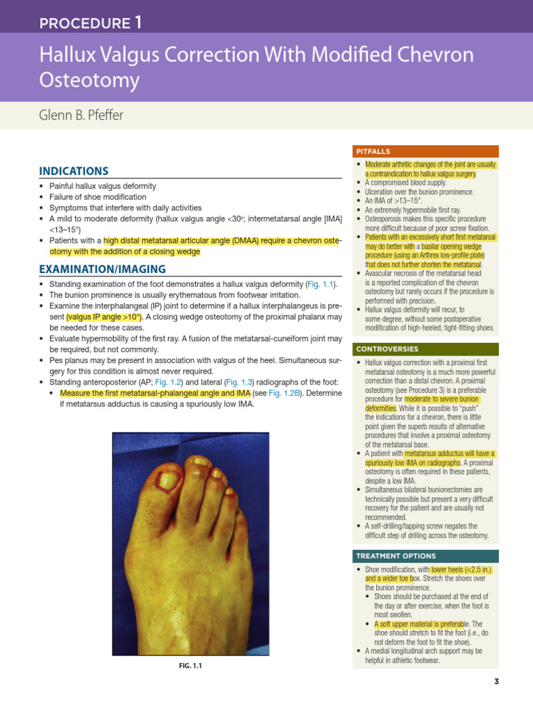 Hallux Valgus Correction With Modified Chevron Osteotomy | PDF | Foot | Toe