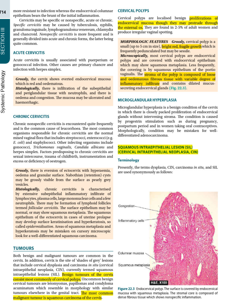 Cervical Cancer | PDF | Cervical Cancer | Neoplasms