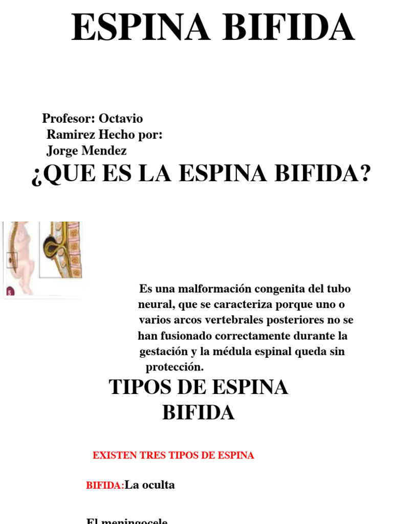 Espina-Bifida - 20231120 212253 0000 | PDF | Sistema nervioso ...