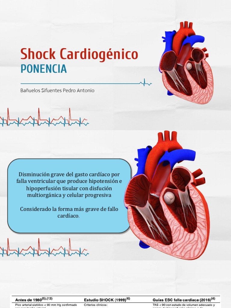 Shock Cardiogénico | PDF | Infarto de miocardio | Corazón