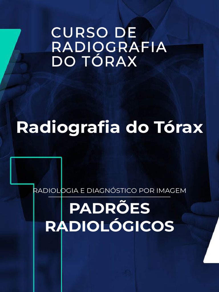 Padrões Radiológicos | PDF | Radiologia | Pneumonia