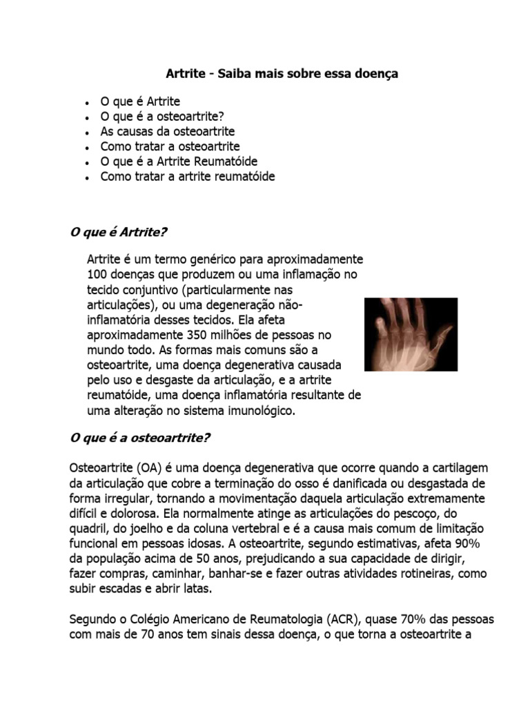 Artrite | PDF | Osteoartrite | Artrite