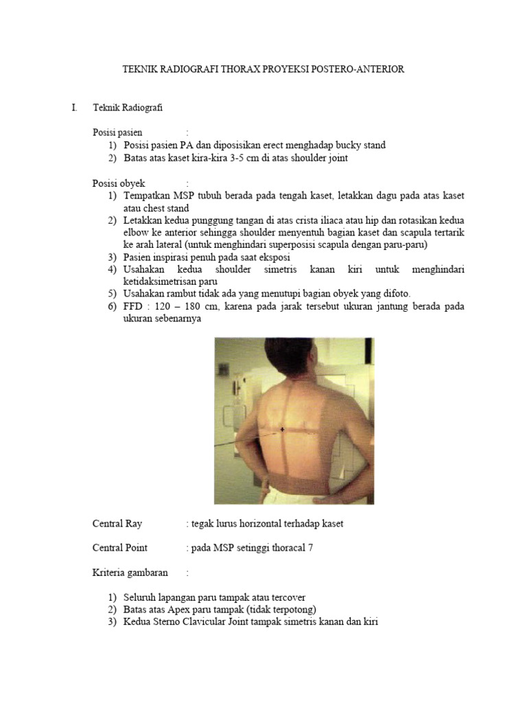Teknik Radiografi Thorax Pa | PDF