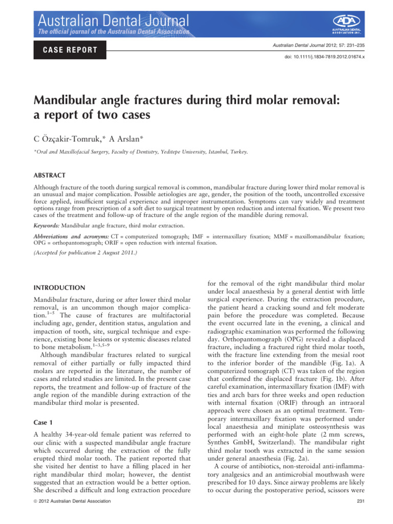 Australian Dental Journal - 2012 - z Akir%E2%80%90Tomruk - Mandibular ...