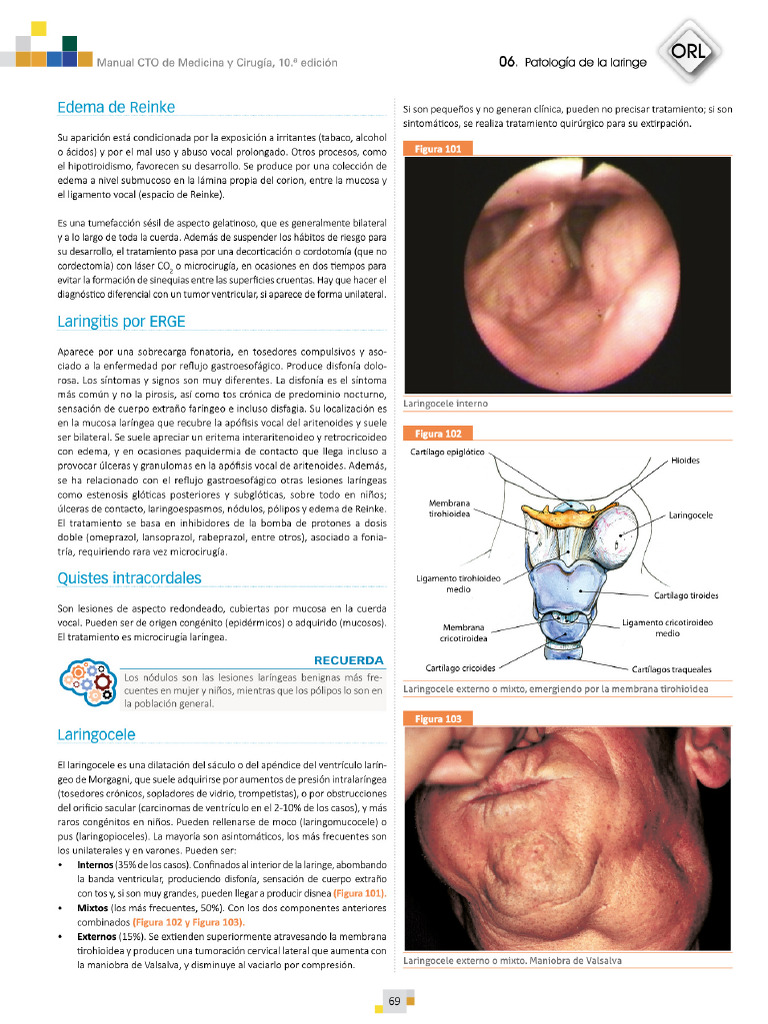 Laringitis Cronica y Traquotomia | PDF | Cáncer | Laringe