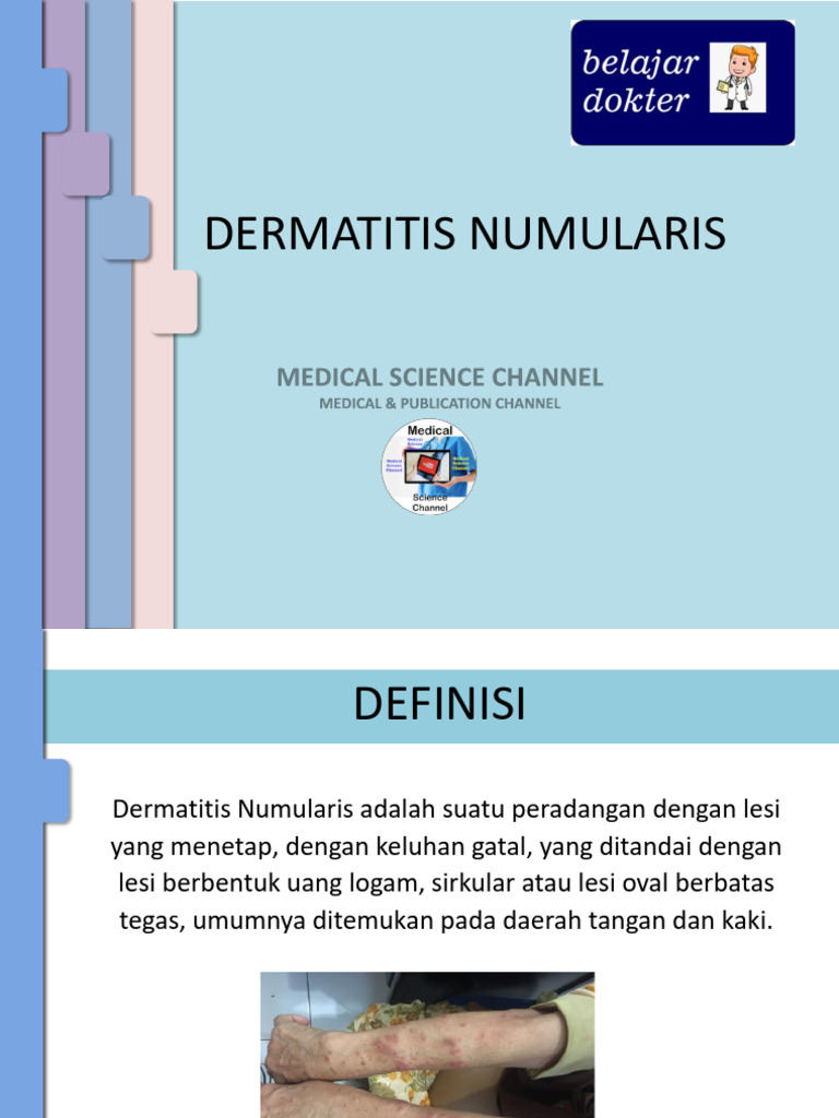 Dermatitis Numularis | PDF