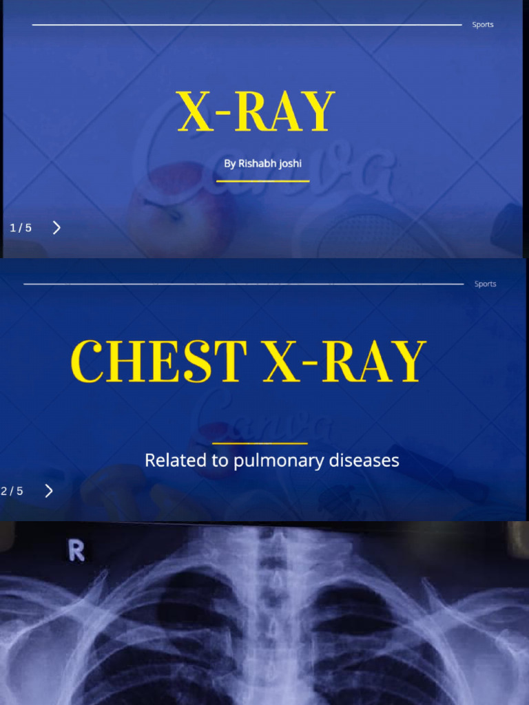 Xray | PDF