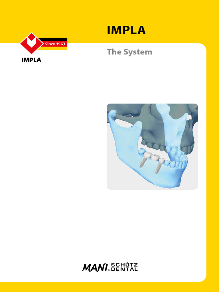 2017 IMPLA System ENG | PDF | Dental Implant | Dentistry Branches