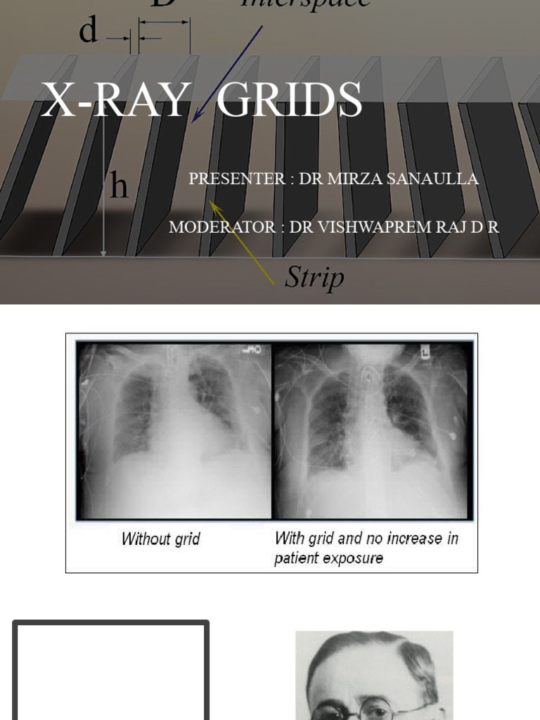 Grids | PDF | Radiography | X Ray