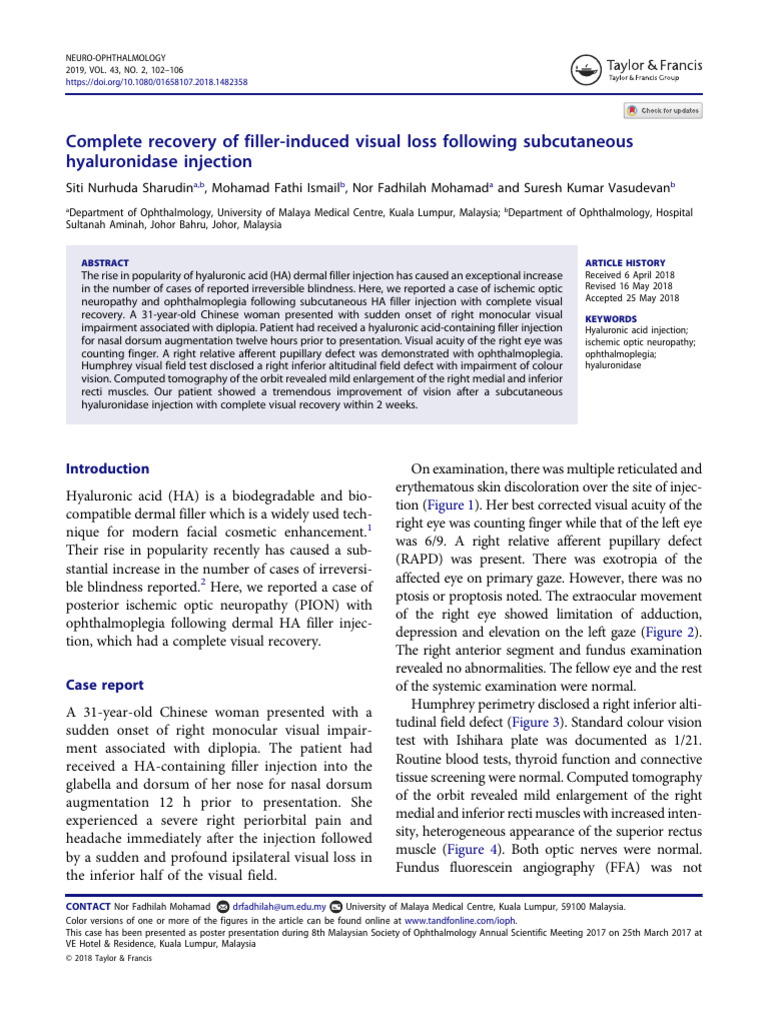 Complete Recovery of Filler-Induced Visual Loss Following Subcutaneous ...