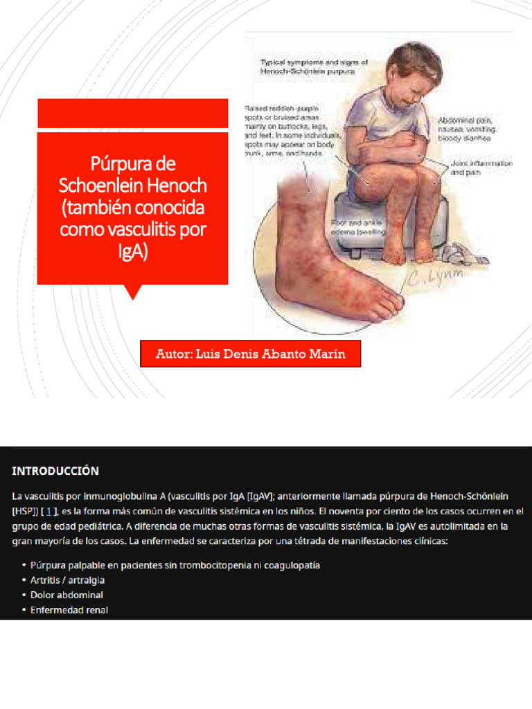 Púrpura de Schoenlein Henoch (vasculitis x IgA) | PDF | Tracto ...