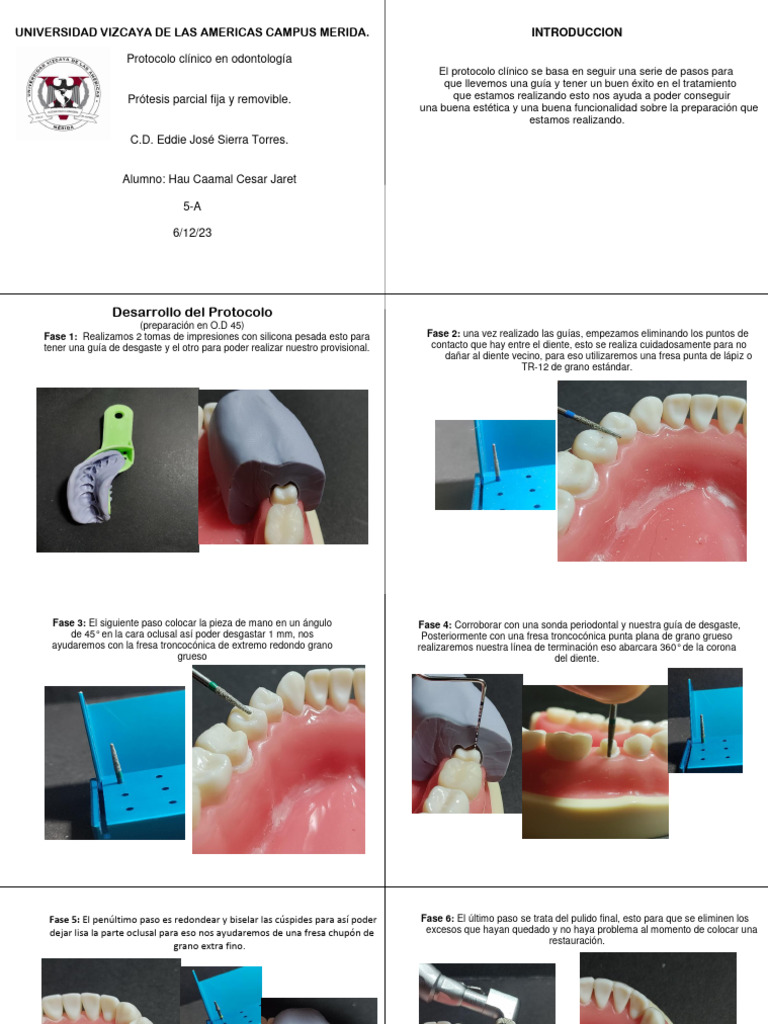 PROTOCOLO PROTESIS 2 | PDF | Dentadura postiza | Especialidades Medicas