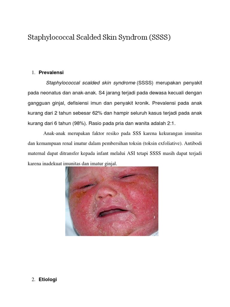 Staphylococcal Scalded Skin Syndrom | PDF
