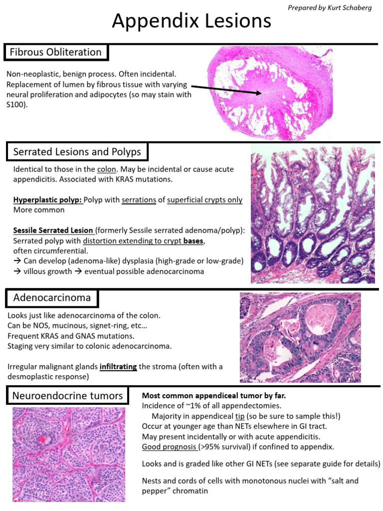 Appendix1 | PDF | Neoplasms | Adenocarcinoma