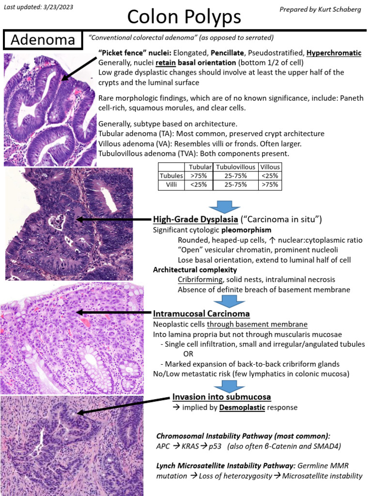 Polyps Advanced | PDF | Adenoma | Colorectal Cancer