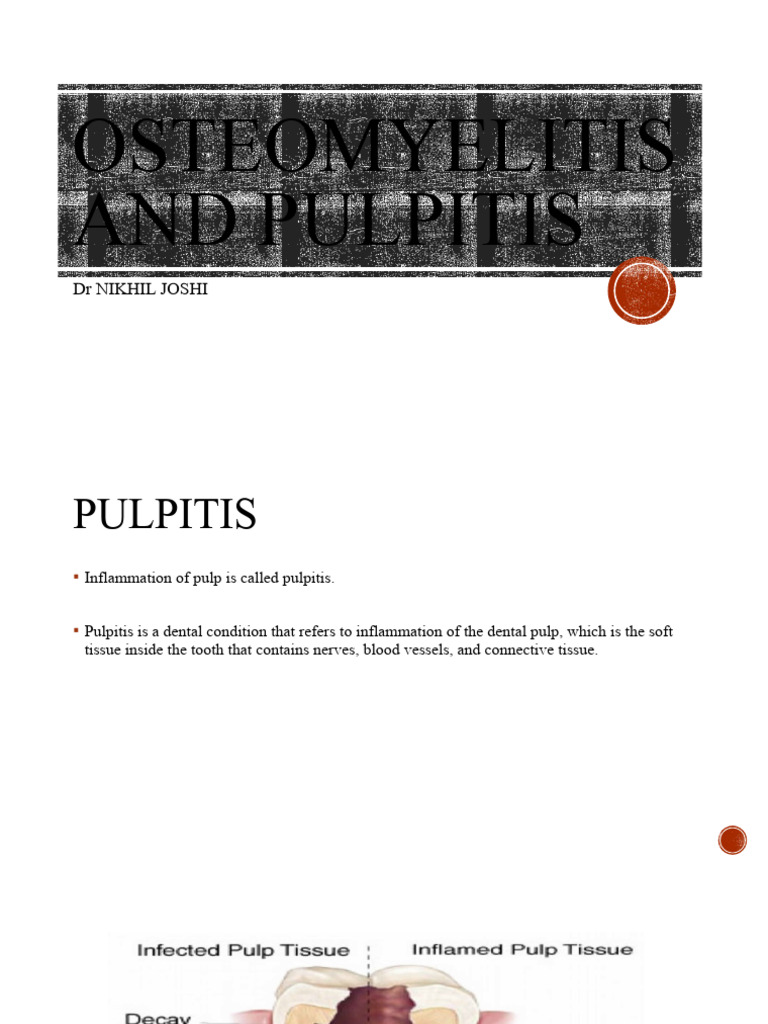 Osteomyelitis and Pulpitis | PDF | Clinical Medicine | Immunology