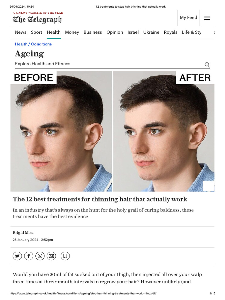 12 Treatments To Stop Hair Thinning That Actually Work | PDF | Hair ...