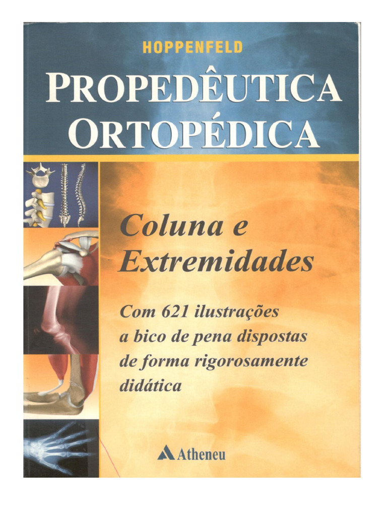 Propedêutica Ortopédica - Hoppenfeld | PDF